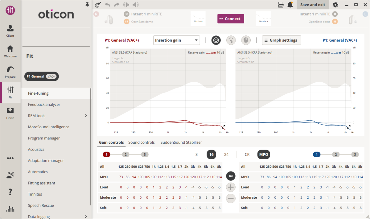 Oticon Genie 2 2025.2 - Download Hearing aid Software